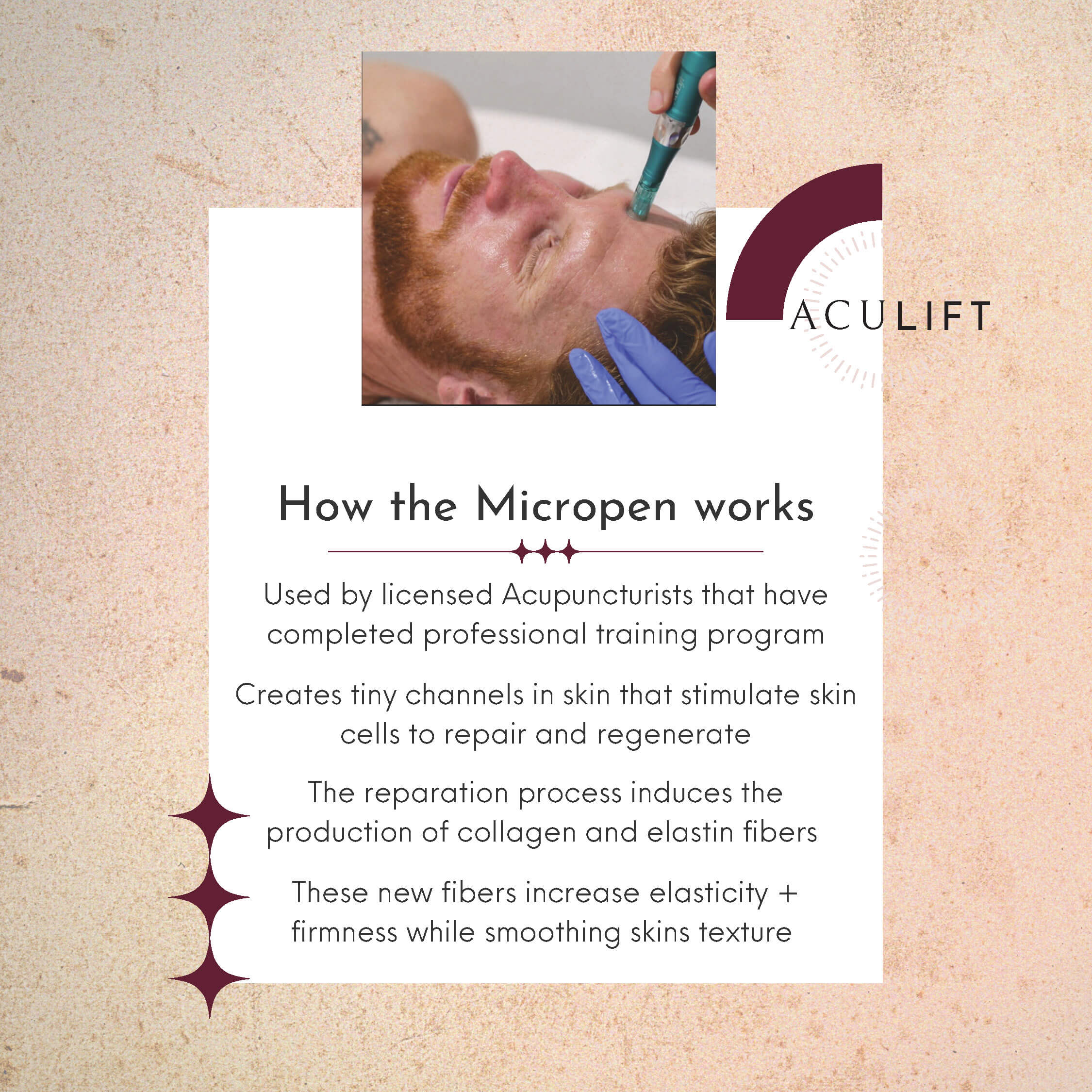 Cosmetic Acupuncture, Microneedling, & Facial Gua Sha and Cupping – Sea ...